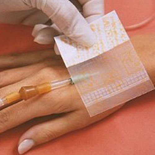 Opsite IV Catheter Securement Dressing 4" x 5.5" Sterile — Mountainside ...