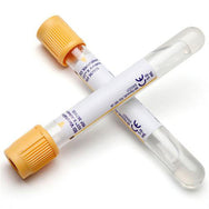 SST Blood Collection Tubes: Serum Chemistry & Serology Tests ...