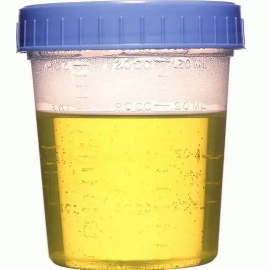 Urine Specimen Collection Cup, Sterile Individually wrapped ...