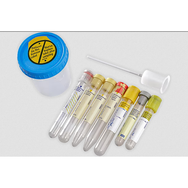 BD 364951 Vacutainer Urinalysis C&S Preservative Tubes 13x75mm, 4.0 mL ...