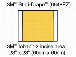 3M™ IOBAN™ 2 Antimicrobial Incise Drape 35” x 23” 10/box — Mountainside ...