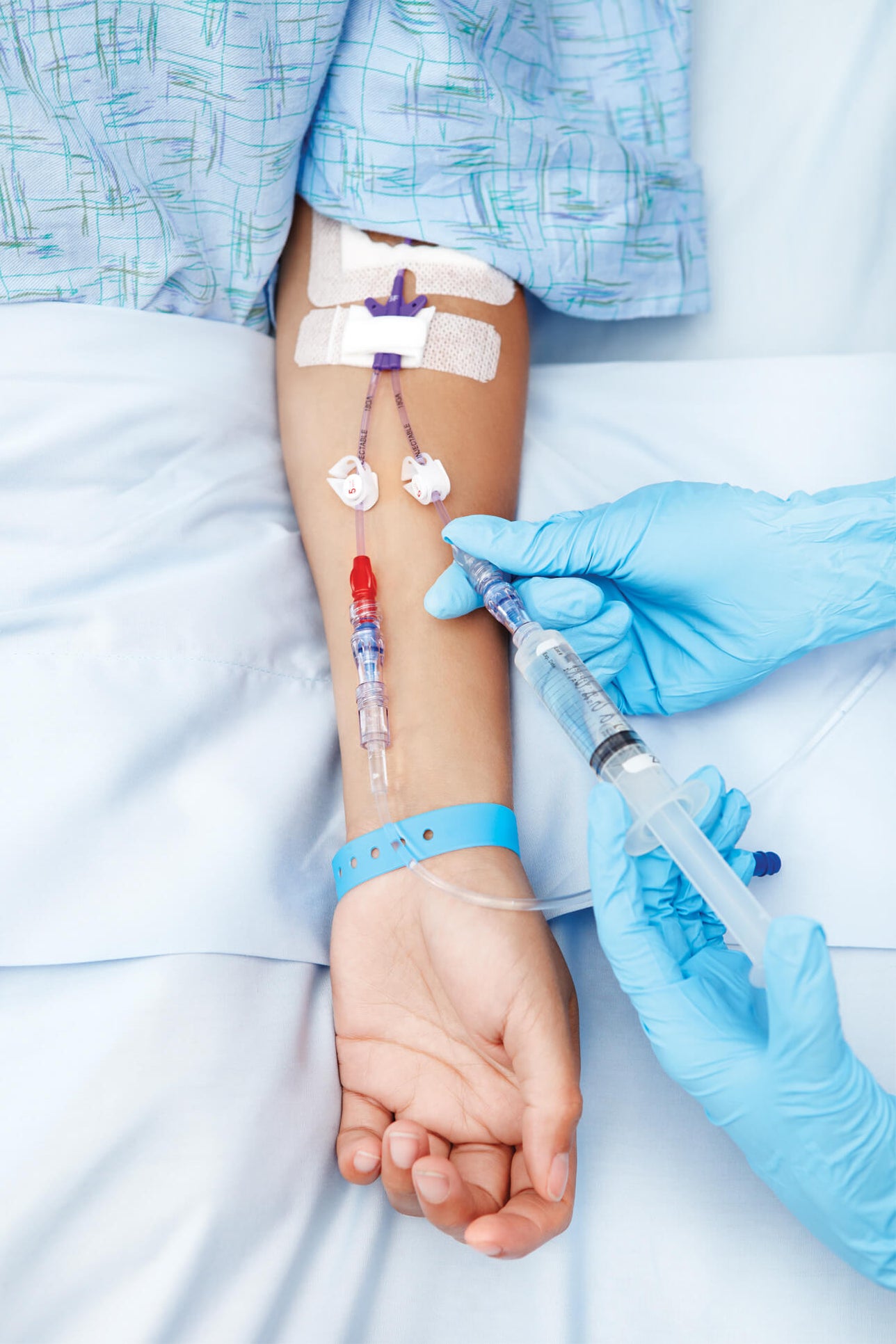 IV Administration Set | Infusion Sets - IV Tubing — Mountainside Medical