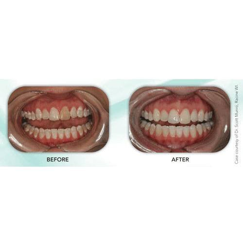 MI Paste Plus Strawberry: Dental Health & Cavity Care — Mountainside ...