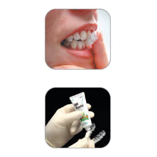 MI Paste with Recaldent 40 Gram Tube Vanilla Flavor — Mountainside ...