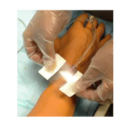 Opsite IV 3000 Dressing 4" x 5 1/2", 10 dressings per box ...