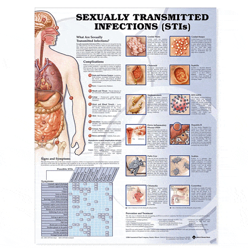 Sexually Transmitted Infections Picture Chart 20 x 26 — Mountainside ...