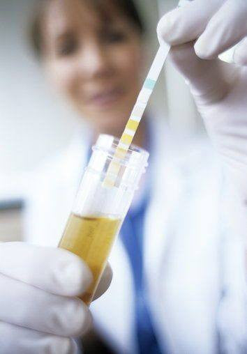 Chemstrips - Chemstrip 9 Urine Test Strips | Mountainside Medical Equipment